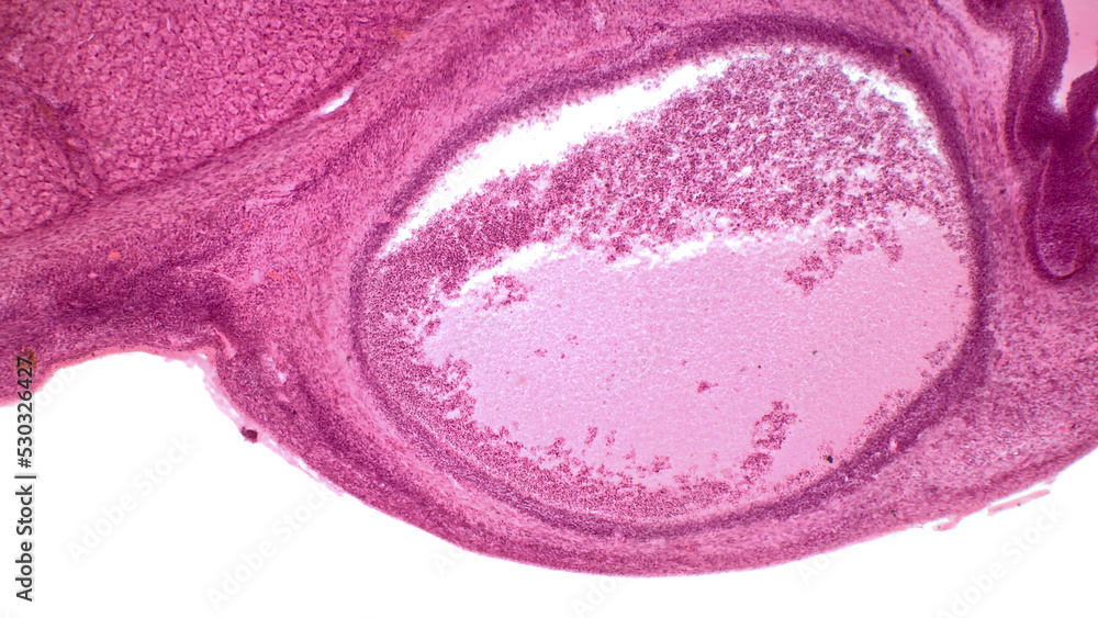 Mature (or Graafian) Follicles. This maybe an off-center cross section ...