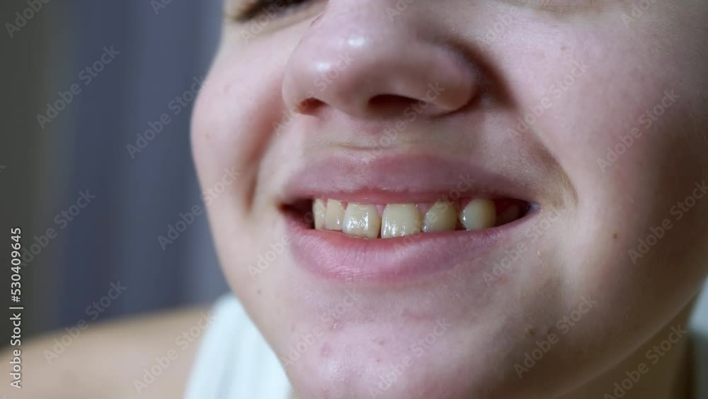 Close-up of Lips and Mouth of a Child with a Beautiful Wide Smile with ...