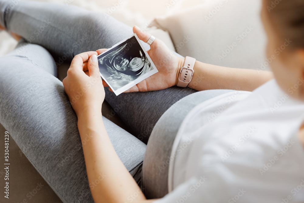 Pregnant woman with ultrasound image on sofa, top view. Concept ...