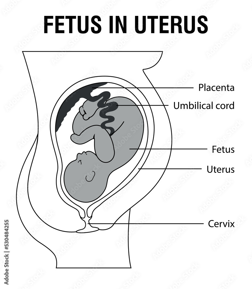 Fetus In Uterus During Pregnancy Placental Locations Pathology fetus-in-uterus-during-pregnancy-placental-locations-pathology