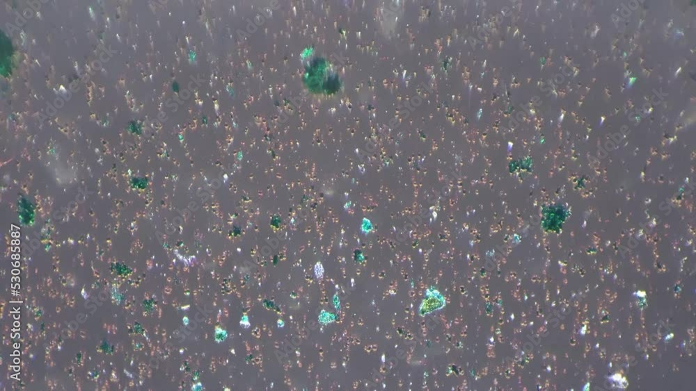 Macro footage of Chlamydomonas whole mount under microscope magnified ...