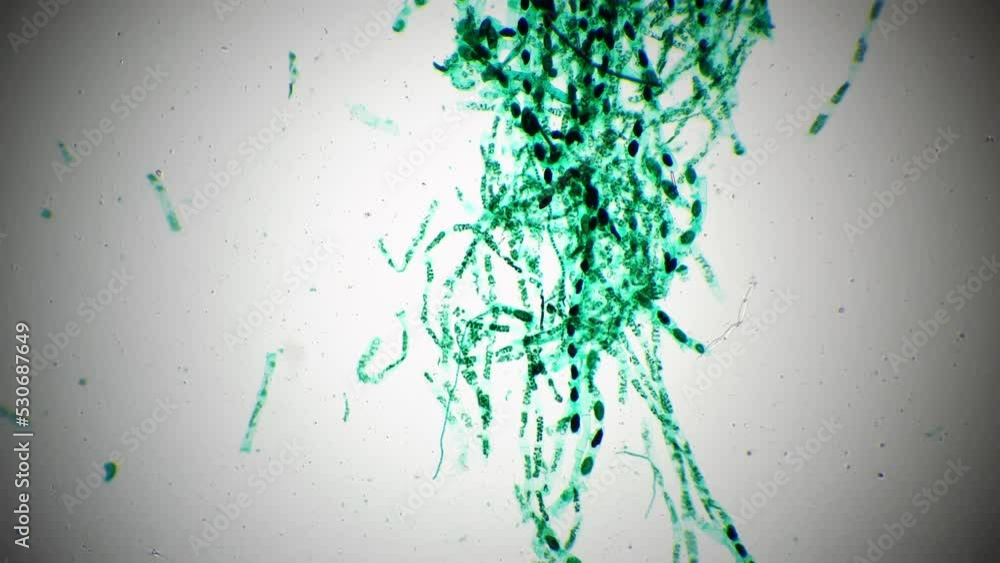 Conjugation of Spirogyra whole mount under microscope 40x against ...