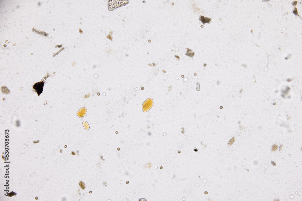Eggs of helminth and Finding parasites in feces, analyze by microscope ...
