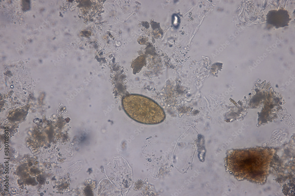Eggs of helminth and Finding parasites in feces, analyze by microscope ...