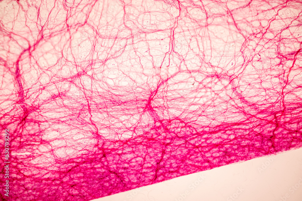 Connective tissue human and Striated muscle human under the microscope ...
