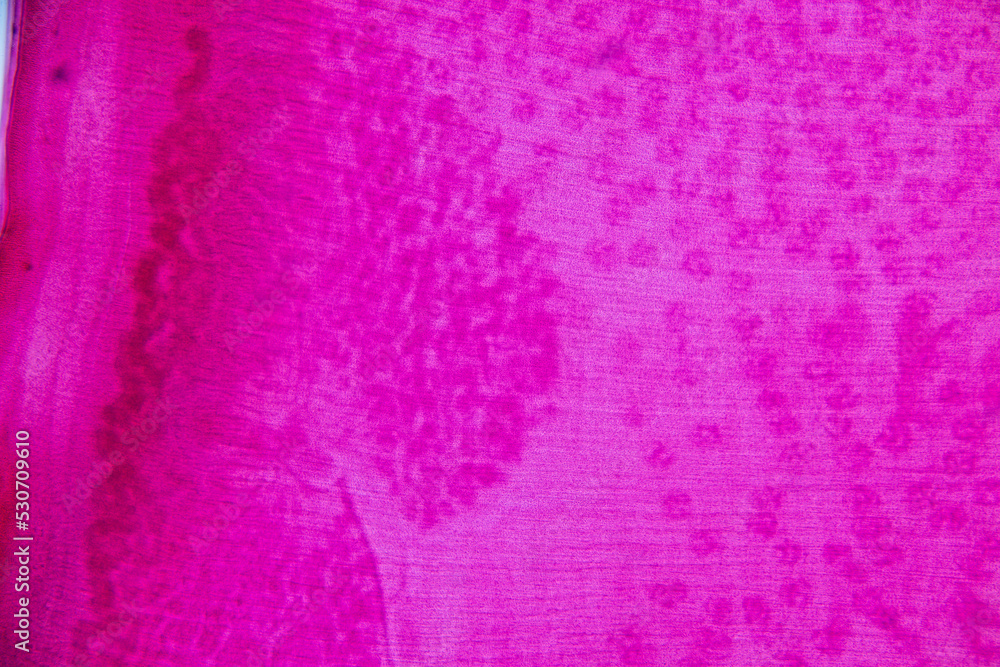 Eggs of helminth and Finding parasites in feces, analyze by microscope ...