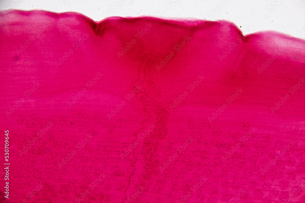 Poster Eggs of helminth and Finding parasites in feces, analyze by ...