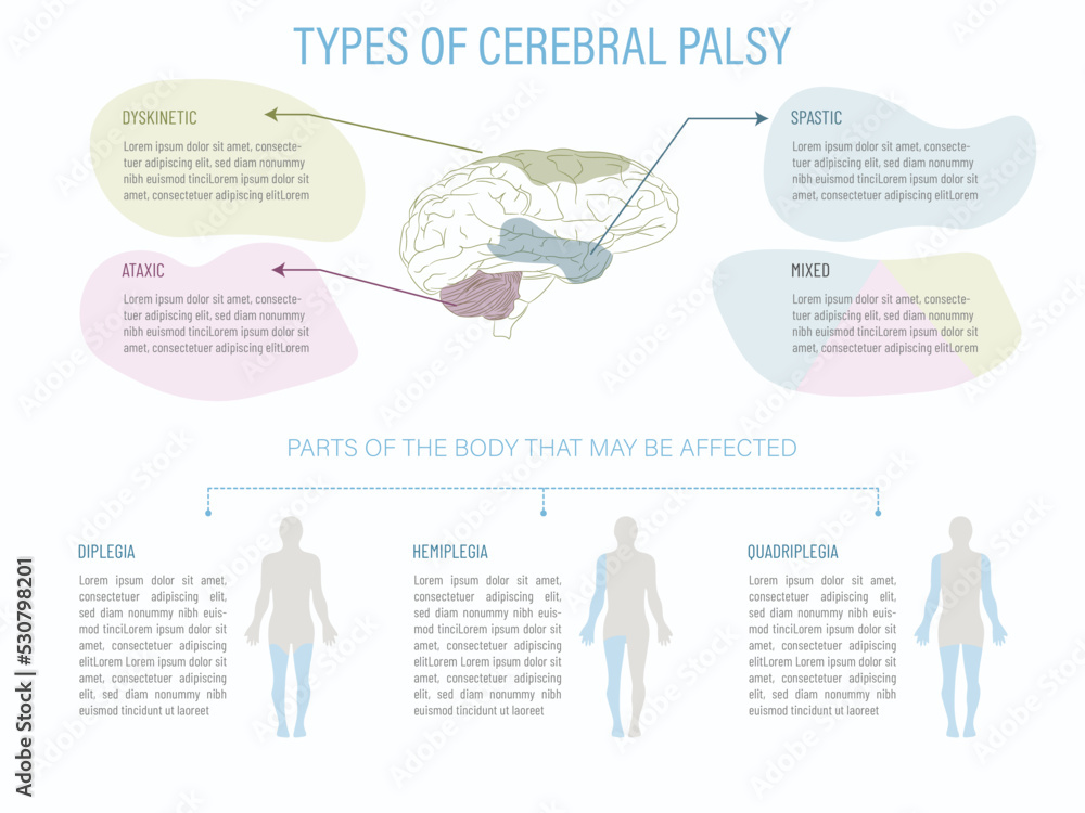 World Cerebral Palsy Day.infographic with a brain and the parts ...