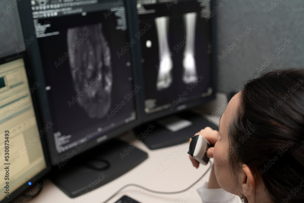 radiology doctor examines foot, ankle x-ray, mr image and reports with ... radiology doctor examines foot, ankle x-ray, mr image and reports with ...