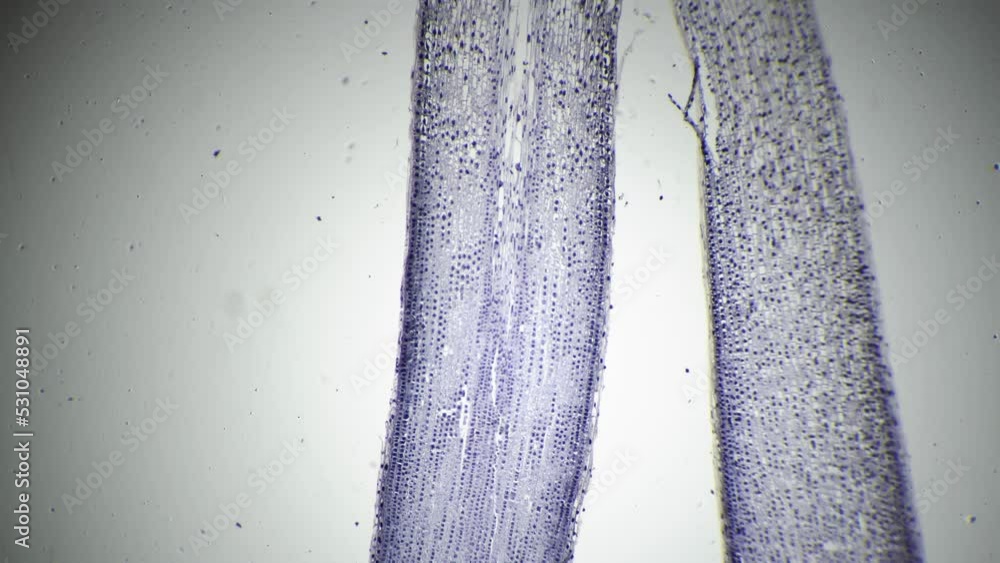Root tip of Allium cepa in longitudinal section magnified by microscope ...