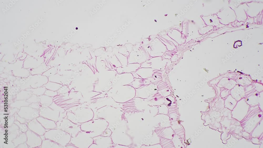 Matuer anther of Lilium in transversal section under microscope 100x on ...