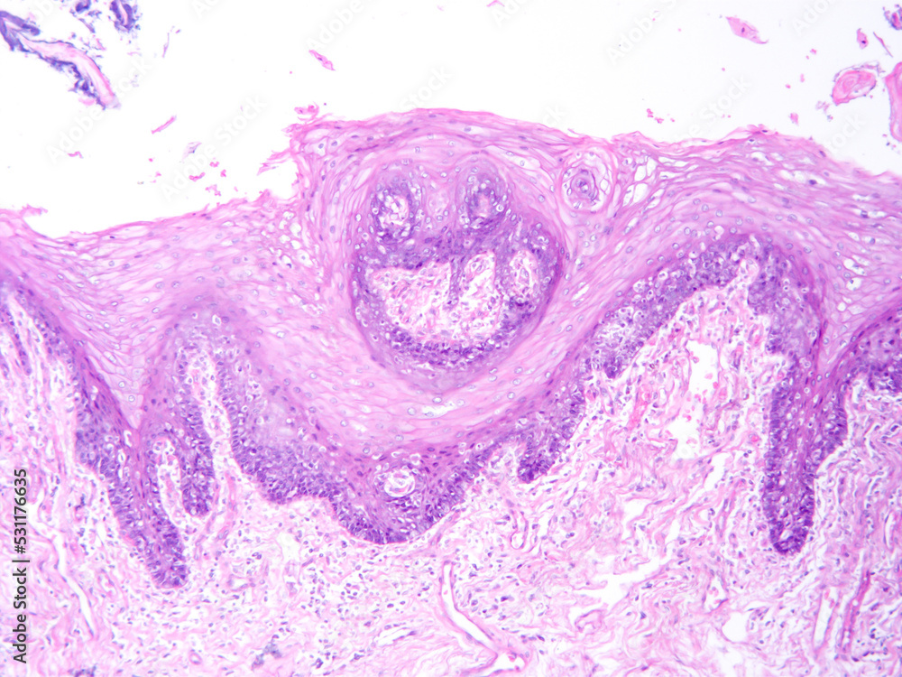 Histology of human tissue, show epithelial tissue and connective tissue ...