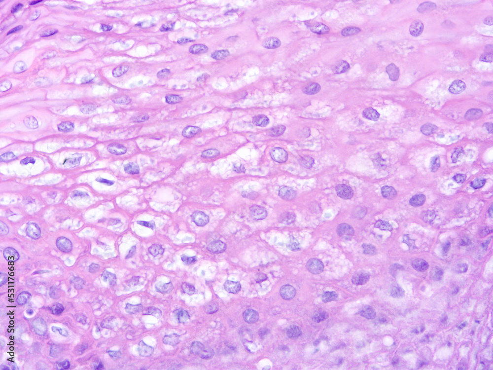 Histology of human tissue, show epithelial tissue and connective tissue ...