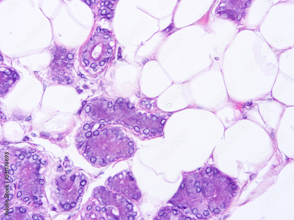 Histology of human tissue, show epithelial tissue and connective tissue ...