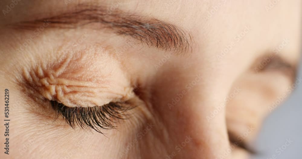 Woman, blue eyes and pain from headache, stress and anxiety or mental ...