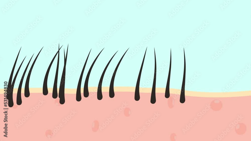 Skin cross section of pore types. Normal, oily, and dry pores. Pale ...
