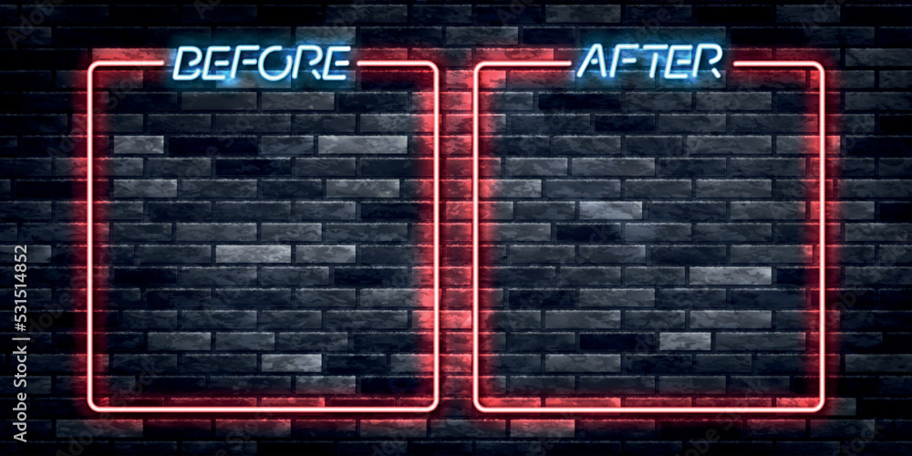 Vector realistic isolated neon sign of Before and After frame logo on ...