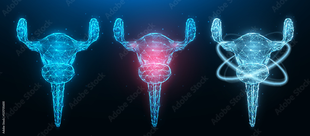 Polygonal vector illustration of inflamed diseased female uterus ...