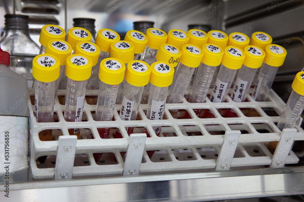 Test tubes with blood samples in the incubator during the process of ...