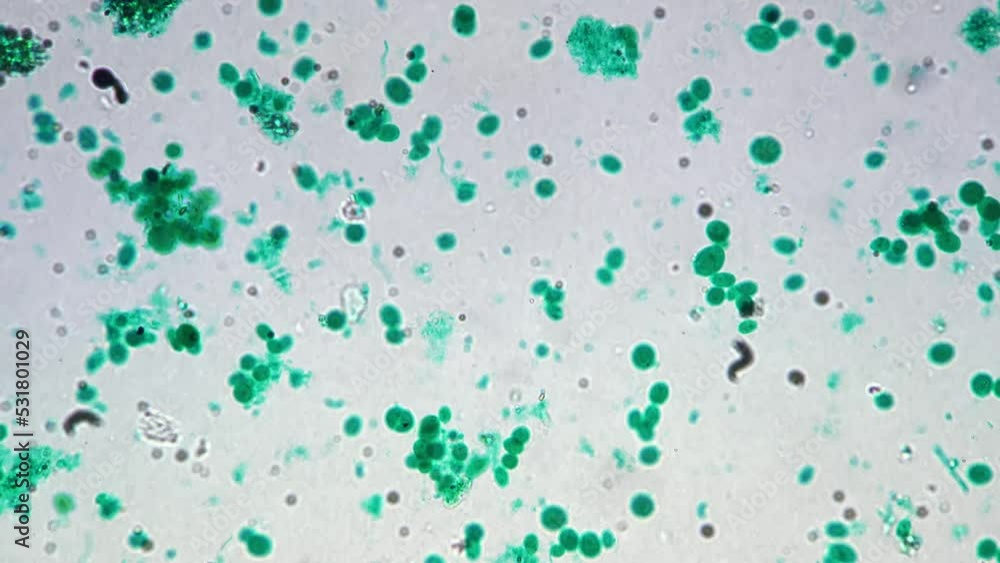 Chlamydomonas whole mount 200x under microscope against bright field ...
