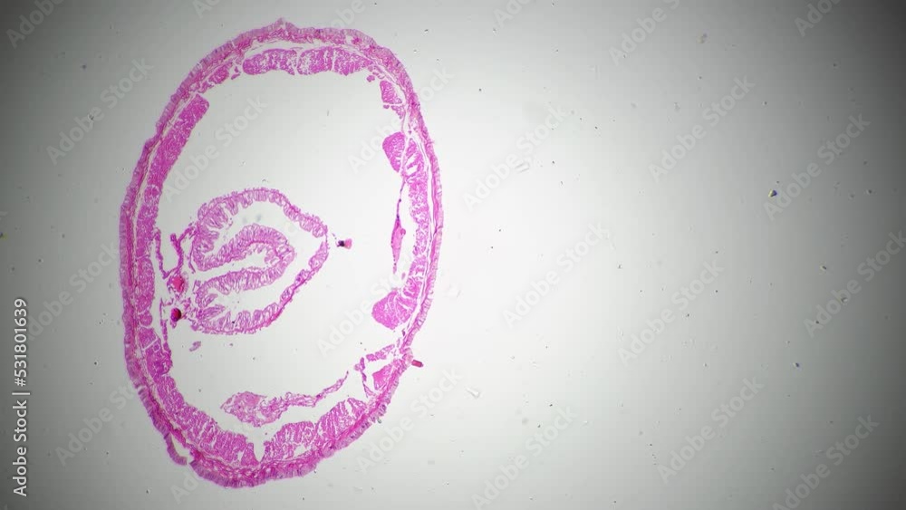 Static microscopic footage of earthworm in transversal section 40x on ...
