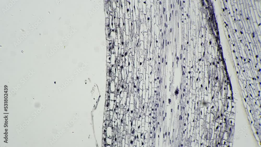 Root tip of Allium cepa in longitudinal section magnified by microscope ...