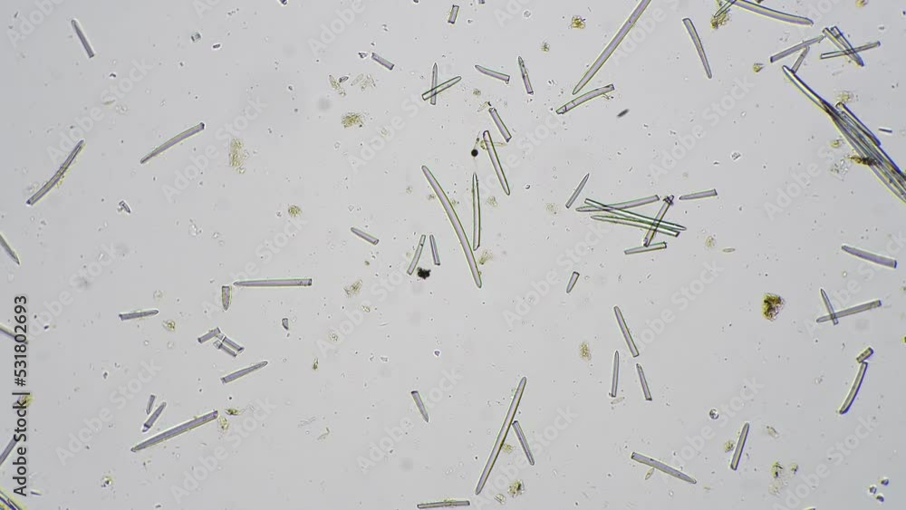 Spincule of Spongia whole mount under microscope 100x on white ...