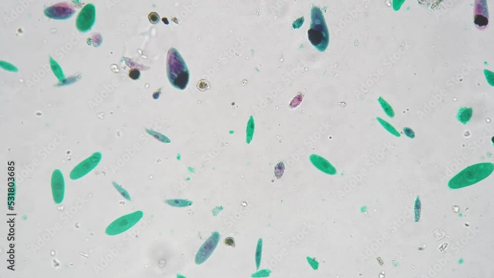 Stockvideo Euglena under microscope with 200 times magnification on ...