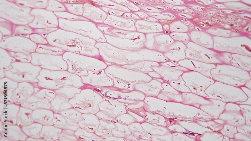 Polliondium of Funaria in longitudinal section under microscope 200x ...