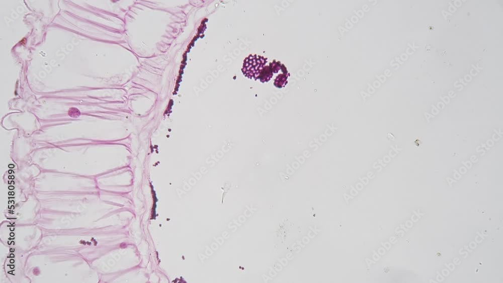 Matuer anther of Lilium in transversal section under microscope 200x on ...