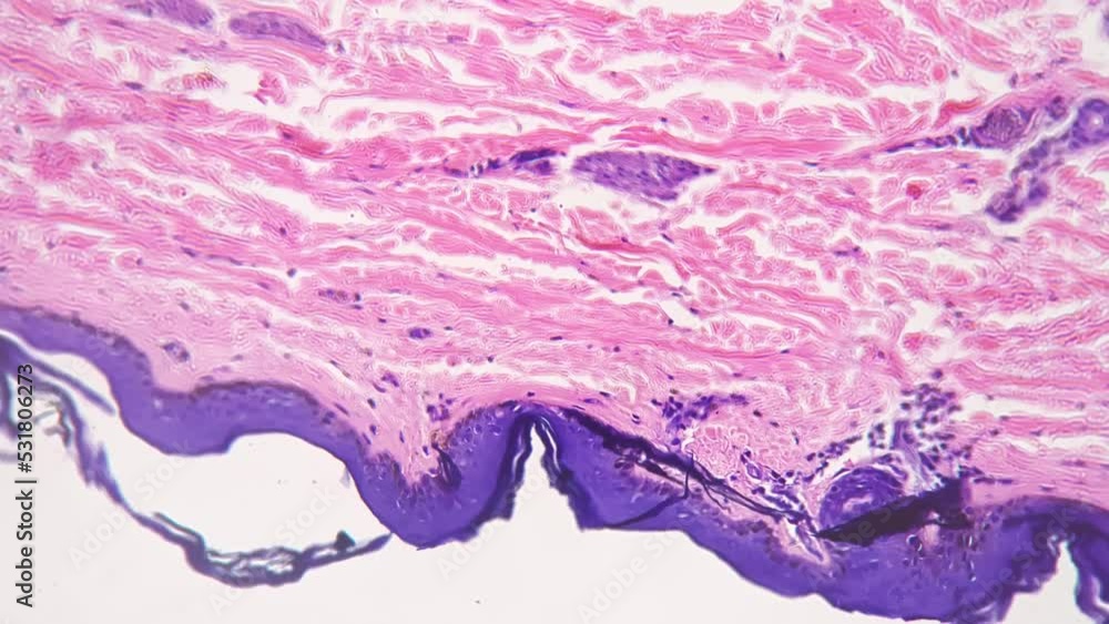 Microscopic 200x view of human skin with shown sweat glands against ...