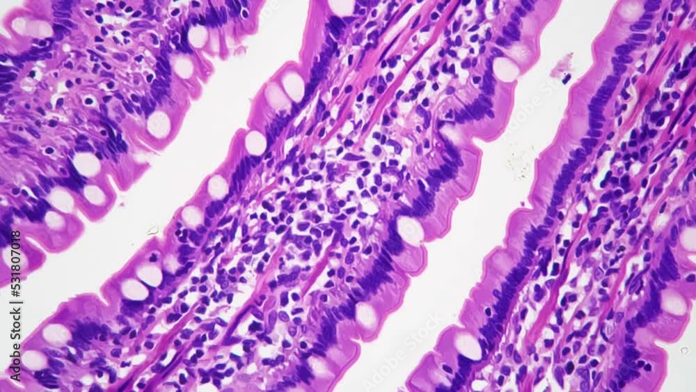 Human smooth muscle whole mount magnified by laboratory microscope in ...