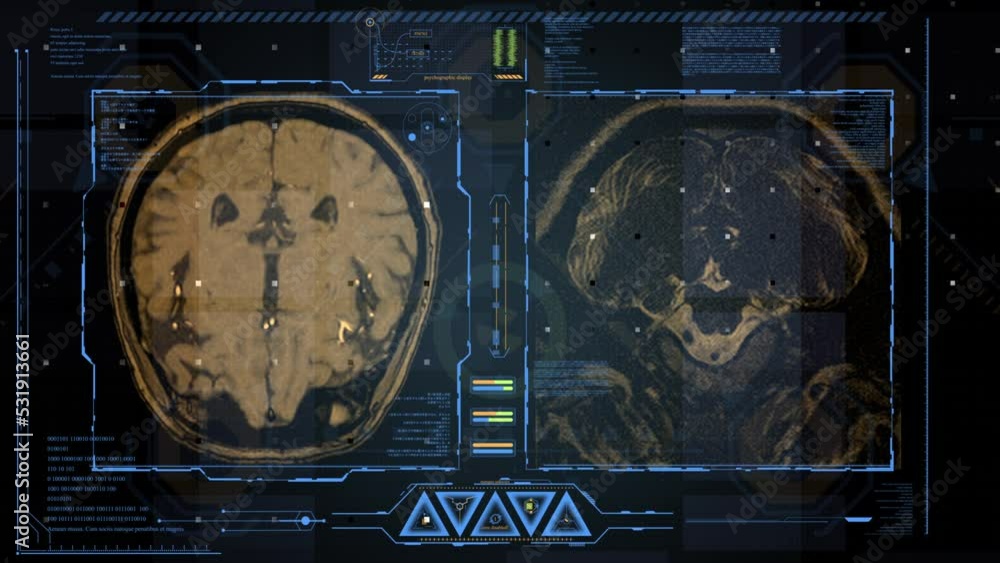 Magnetic Resonance Images of the Brain. A High-Tech Screen Displays the ...