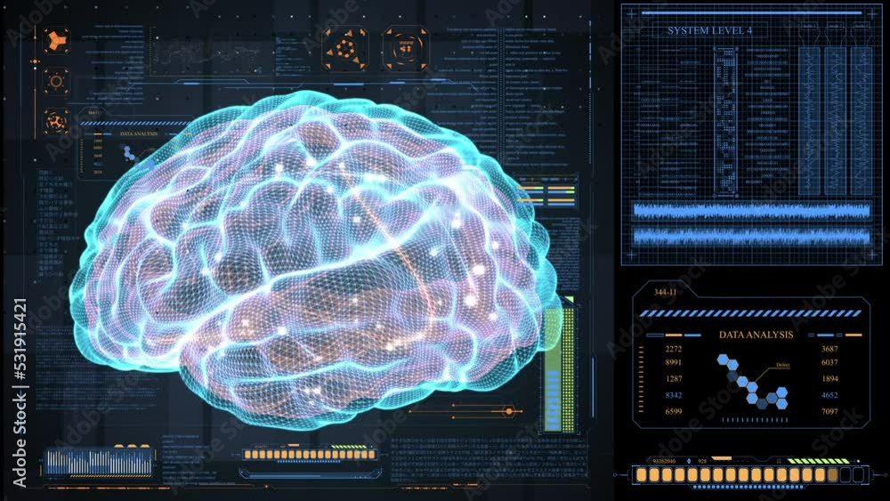 Magnetic Resonance Images of the Brain. A High-Tech Screen Displays the ...
