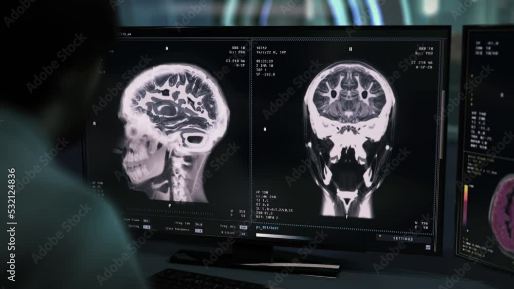 Modern Scanner analysing the injured head organs during medical therapy ...