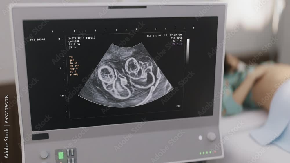 Medical Ultrasound Device Reveals Twin Children During Mother ...
