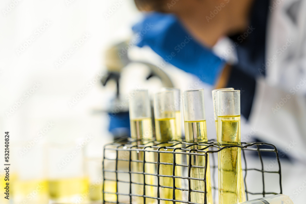 Cooking oil lab test , Quality control of vegetable oil industry ...