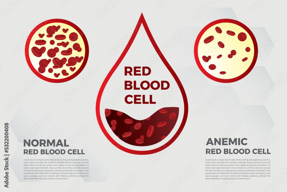 Anemia Iron red blood cell medical vector illustration medical. Stock ...