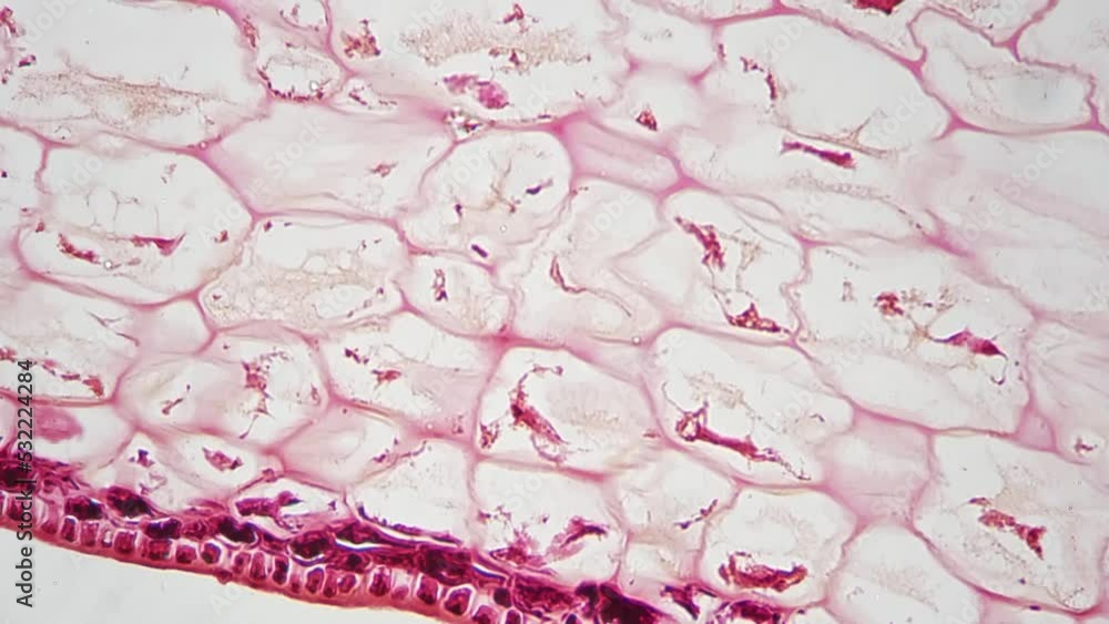 Polliondium of Funaria in longitudinal section under microscope 400x ...