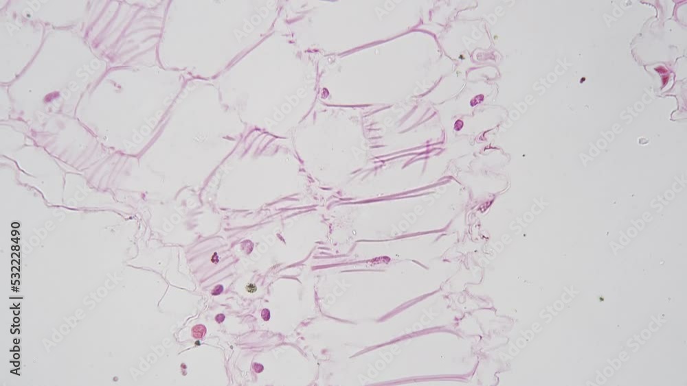 Matuer anther of Lilium in transversal section under microscope 200x on ...