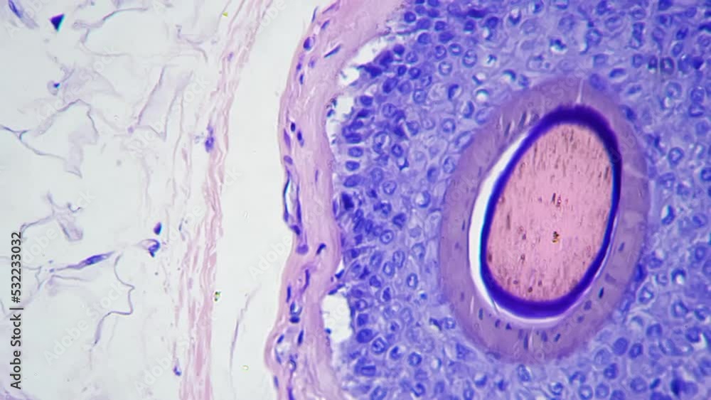 Skin of human shown with hair follicles in section filmed under ...