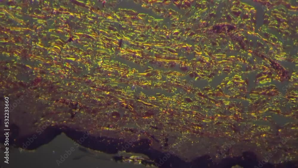 Sweat glands on human skin filmed under microscope 100x with cross ...