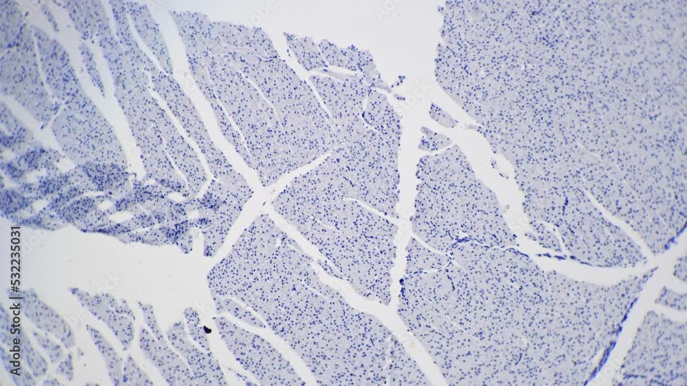 Cardiac muscle in section filmed on bright field background under ...