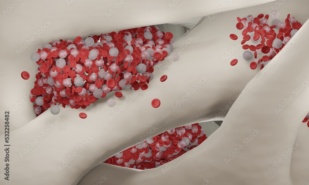 Bone marrow producing blood cells (hematopoiesis) Stock Illustration ...