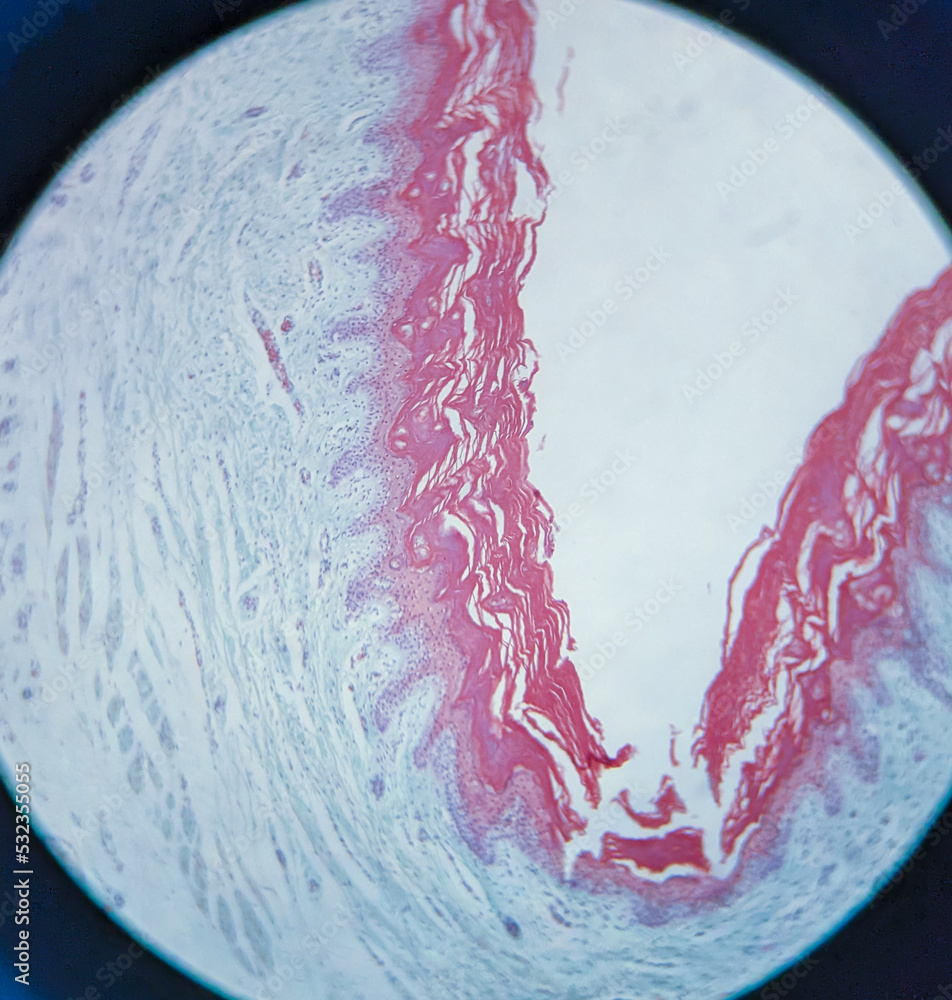 photo of gland tissue under the microscope Stock Photo | Adobe Stock