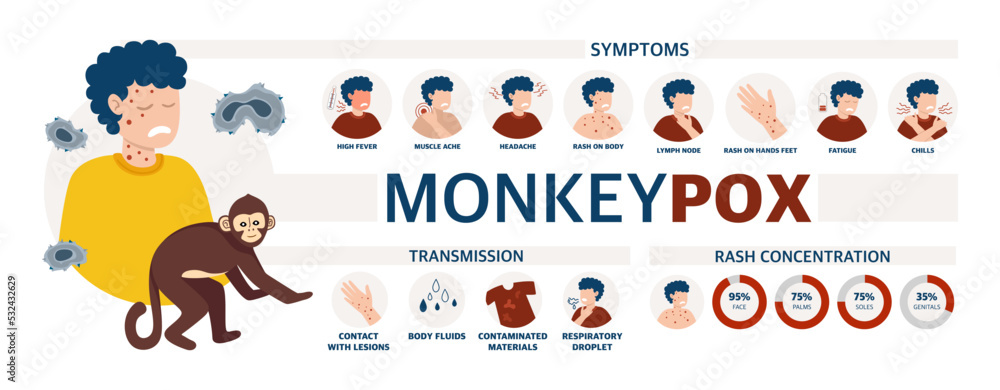 Monkey pox virus Poster to inform about the pandemic and the spread of ...