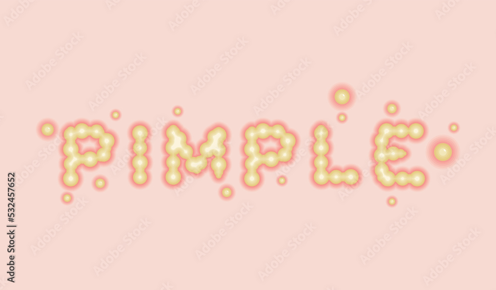 Pimple lettering. Acne lettersTypography. whelk typography Vector ...