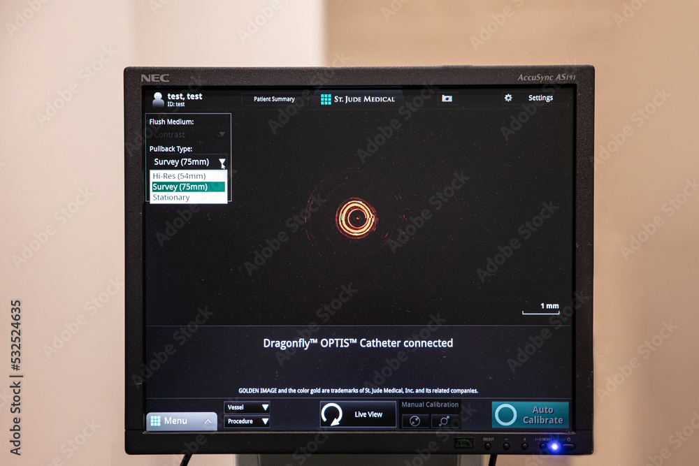 Istanbul, Turkey - September 20, 2022 ; Optical coherence tomography ...