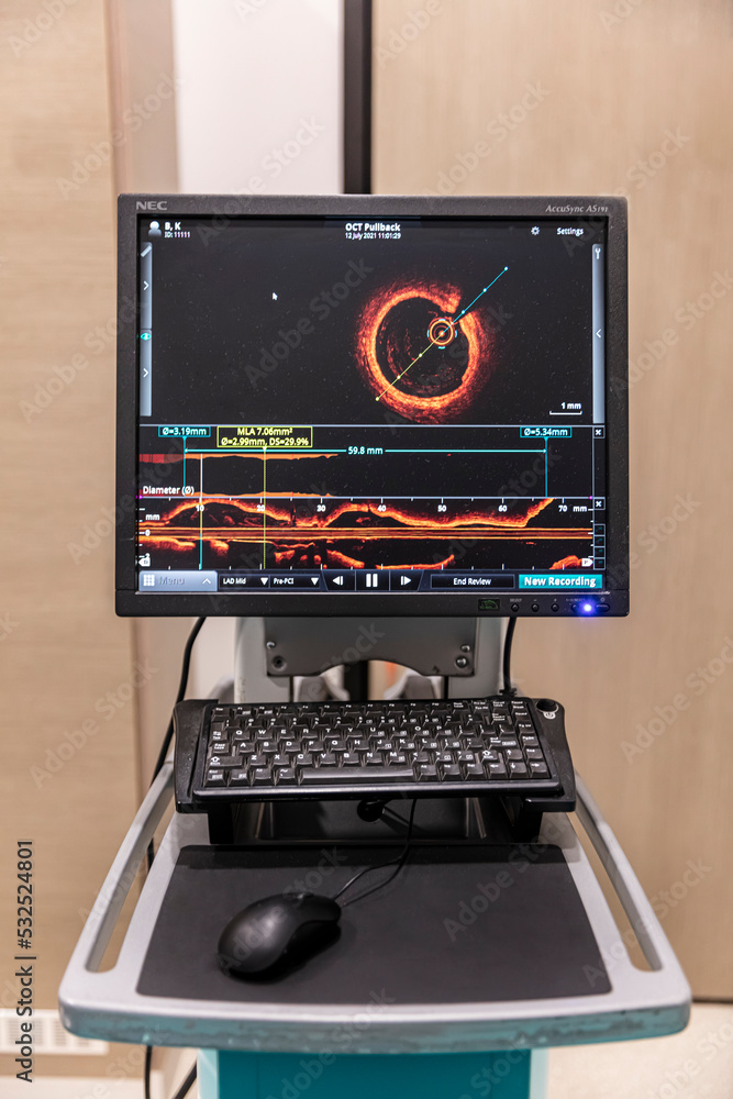 Istanbul, Turkey - September 20, 2022 ; Optical coherence tomography ...