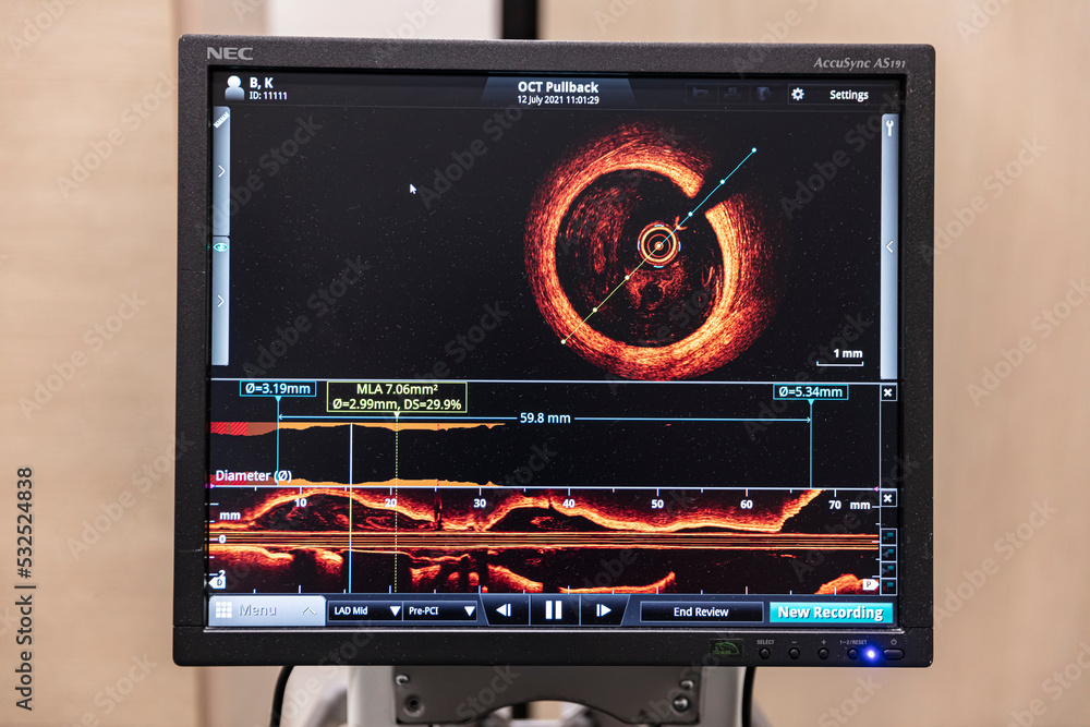 Istanbul, Turkey - September 20, 2022 ; Optical coherence tomography ...